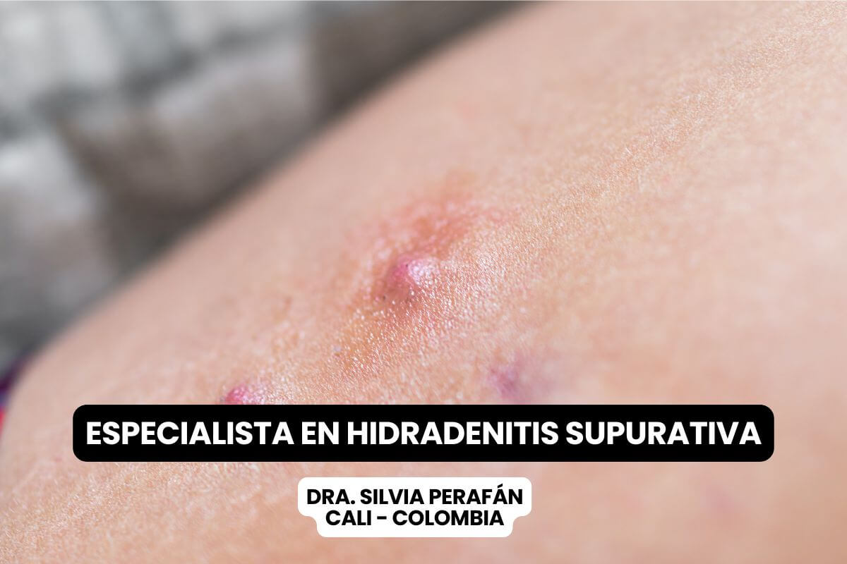 Dra. Silvia Perafán Constanzo PIELSANADERMA Dermatólogo Cali