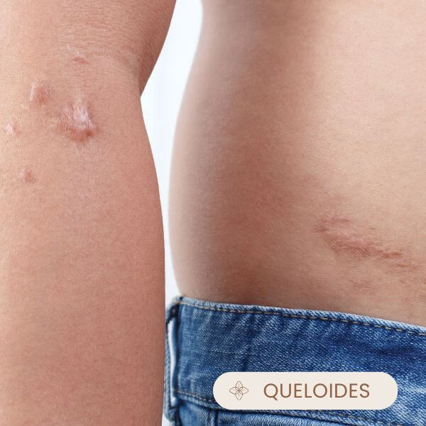 Dra. Laura Sofía Habib Araújo Dermatólogo Bogotá